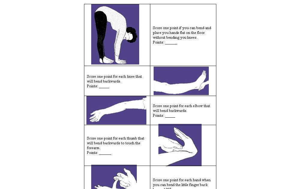 beighton scale eds test - Frank Loves Beans